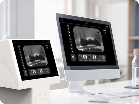 Dental Digital x-Ray Phosphor Plate (PSP) Scanner | Dynair