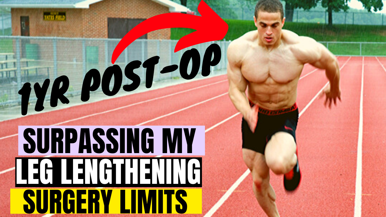 1619058141_Surpassing-Leg-Lengthening-Surgery-Limits-1.png