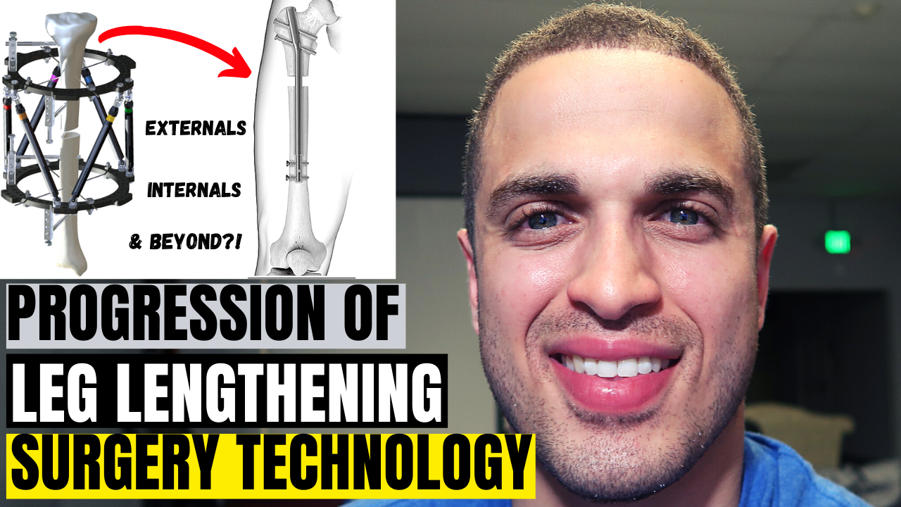 Really there’s 3 different categories of lengthening devices. You have ...